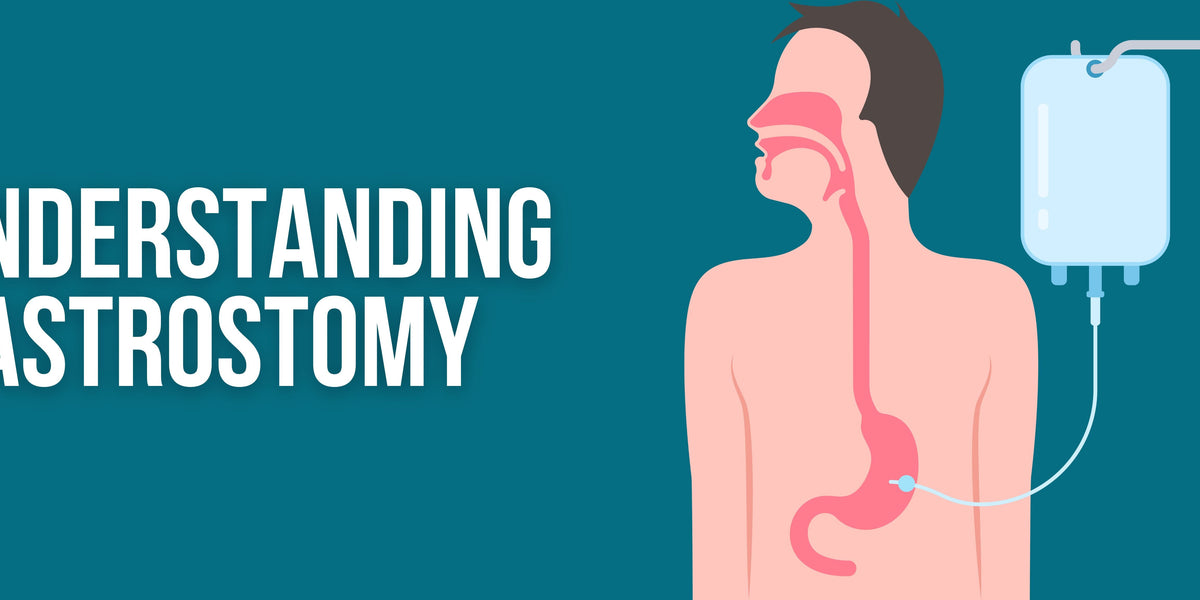 Understanding Gastrostomy: Definition and Purpose — Medical Supply Pros